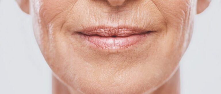 ⋆ Cómo mantener y recuperar la elasticidad de la piel ⋆ Colágenos.info